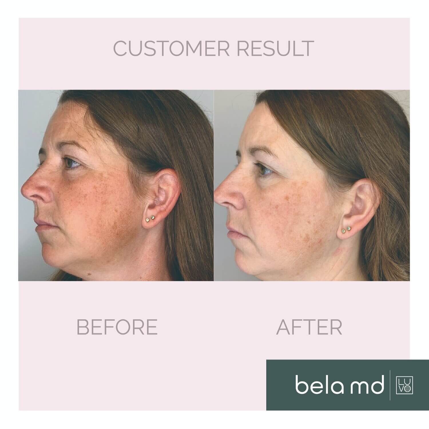 Bela MD Charlotte | Aesthetic Surgery of Charlotte