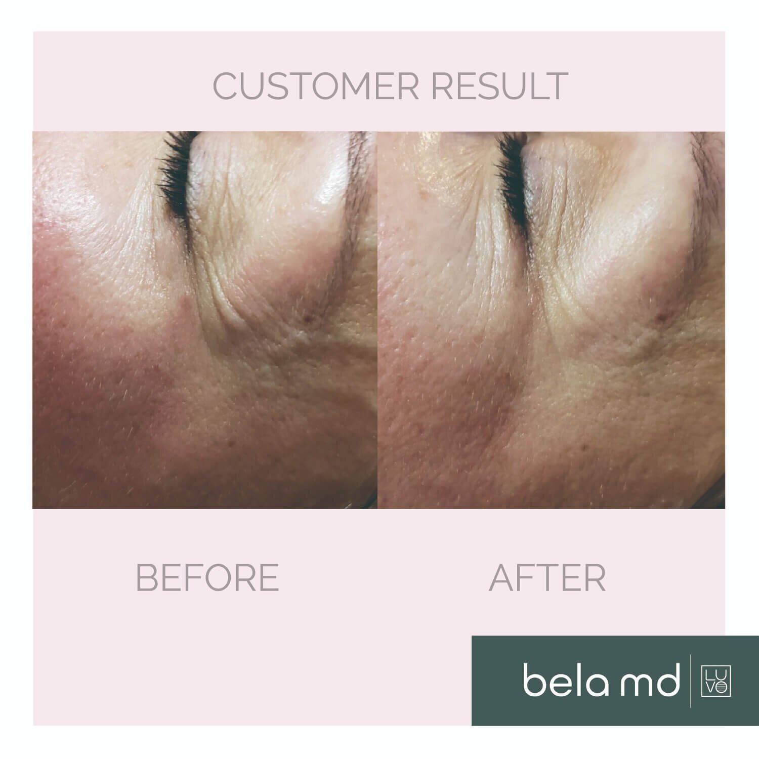Bela MD Charlotte | Aesthetic Surgery of Charlotte